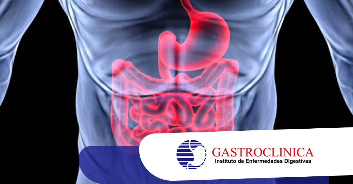 GASTROCLINICA | Pirosis